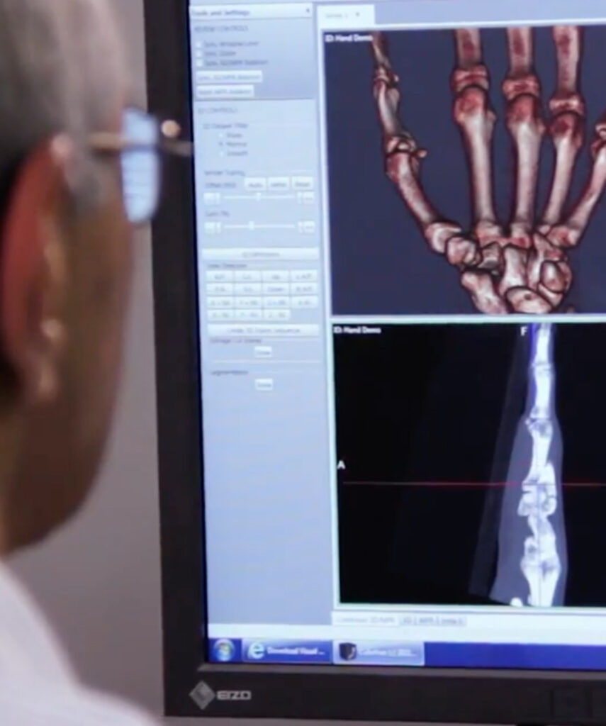 About - CurveBeam AI Investors